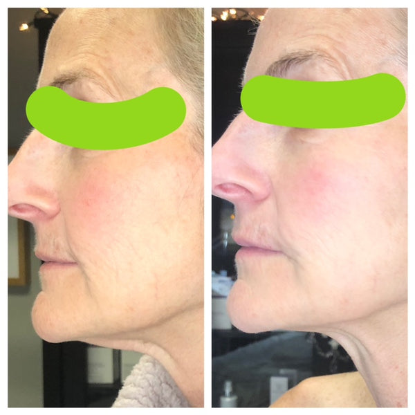 Tama Research Microcurrent...A Non-Surgical Facelift Using The MiTAMA ...
